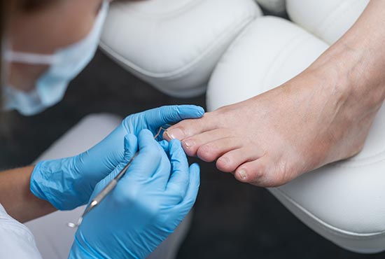 Pédicure-podologue : pourquoi consulter et quand y aller